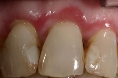 Img 7796 epkyu4 - Eugenol