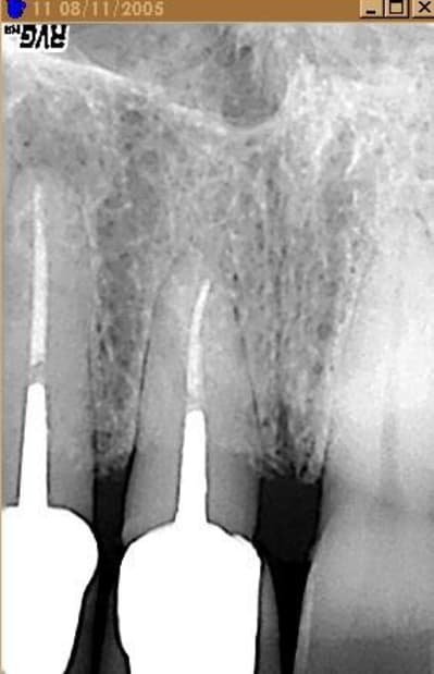 Egression tu4x9z - Eugenol