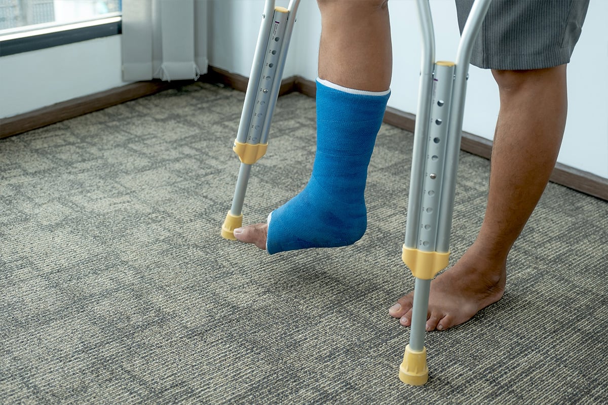 Lisfranc injuries and commonly missed diagnosis